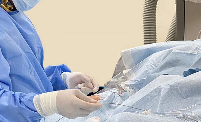 ¿Qué es un cateterismo cardiaco? – Dr. Luis Arboine Aguirre